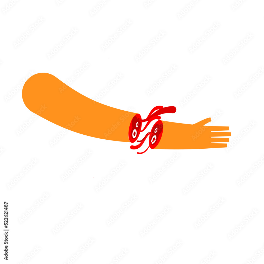 The arm amputation injury illustration on isolated backgroound. Stock ...