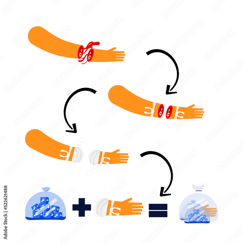 the arm amputation injury and first aid care illustration on isolated ...