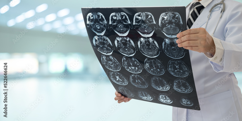 Foto de radiology doctor examines film x-ray brain by ct scan mri of ...