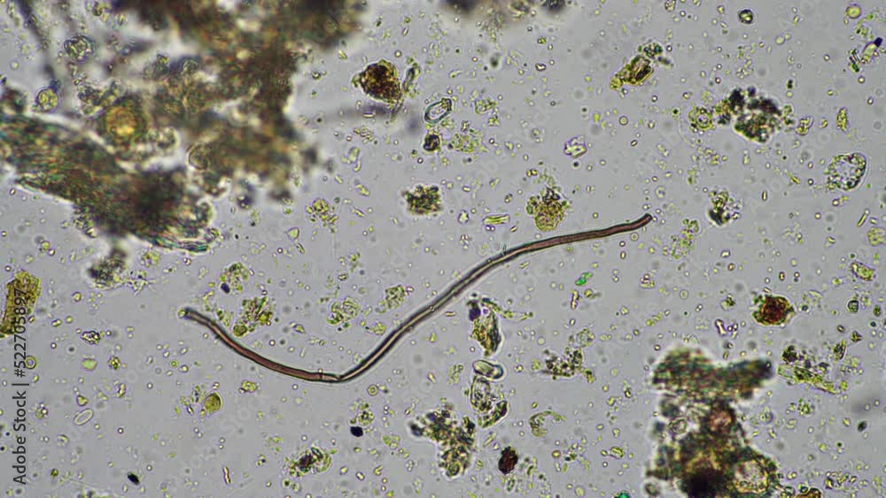 soil fungi measuring soil carbon, microorganisms and soil biology, with ...