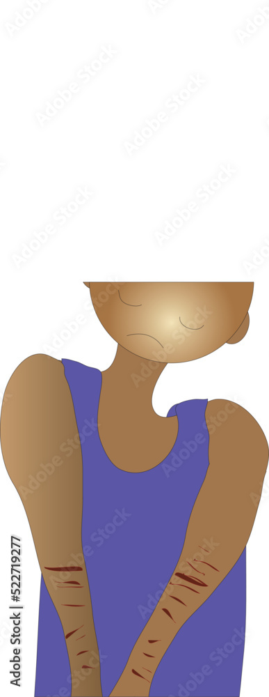 Self-harm scars visible on a young man's arms Stock Vector | Adobe Stock