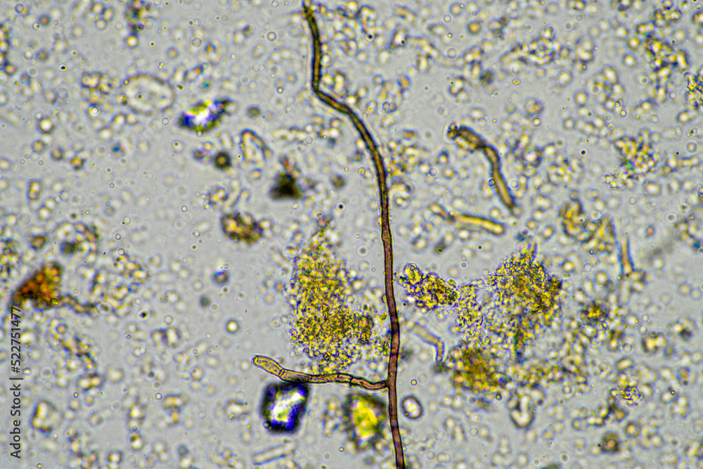 soil microbes organisms in a soil and compost sample, fungus and fungi ...