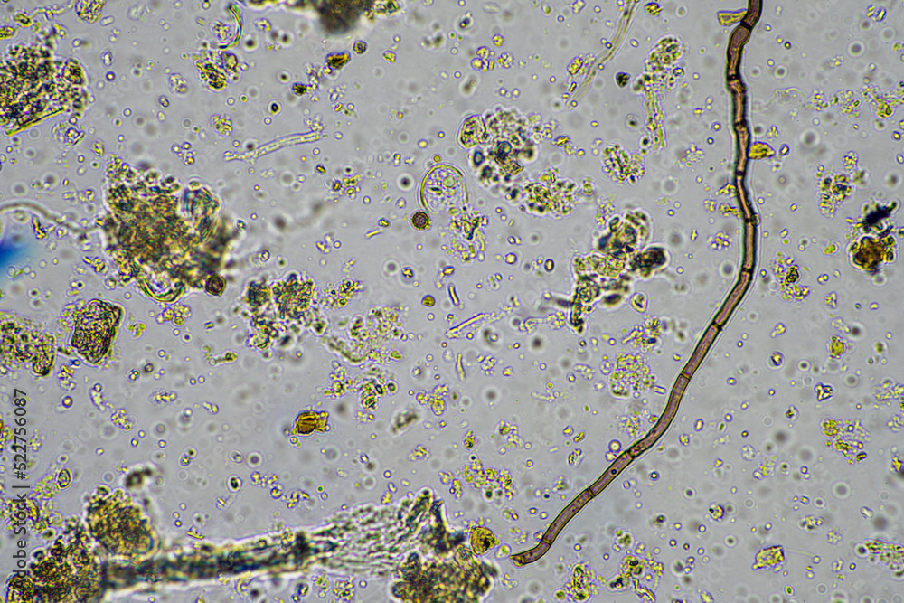 Foto de soil microbes organisms in a soil and compost sample, fungus ...