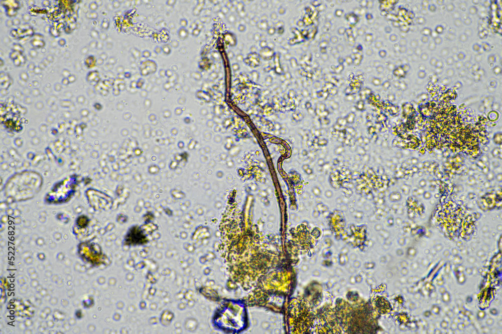 Soil fungi and fungus in a biology soil test in Australia. Bacteria and ...