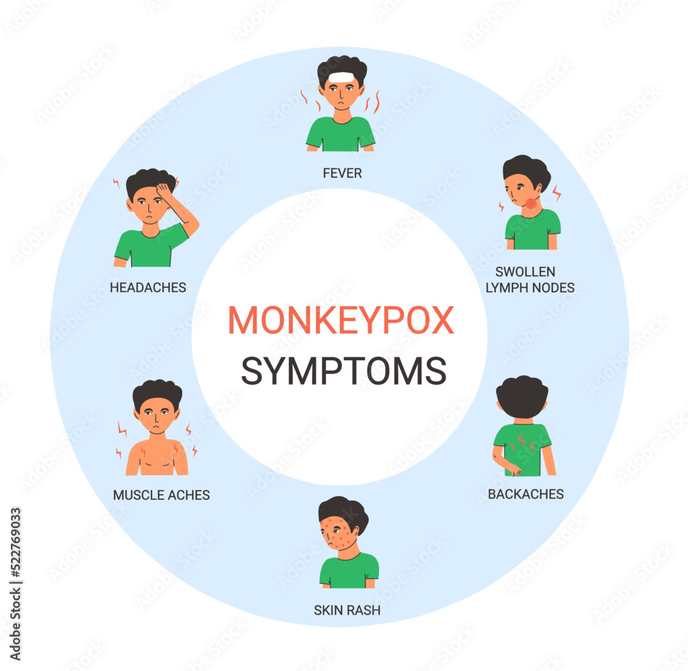 Monkeypox virus symptoms infographic. Medical diagram Stock Vector ...