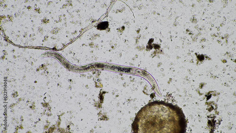 Vidéo Stock microorganisms and soil biology, with nematodes and fungi ...