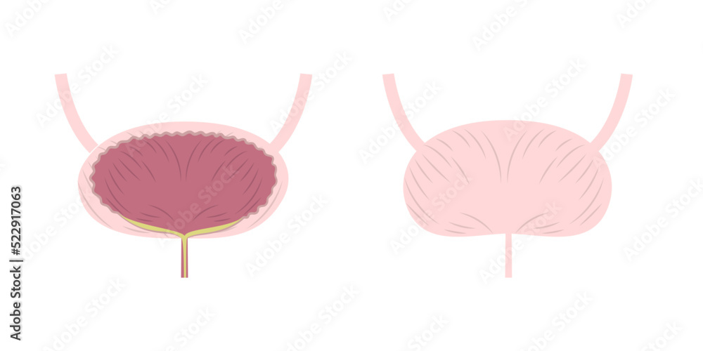Internal and external view of urinary bladder. Medical chart of ...