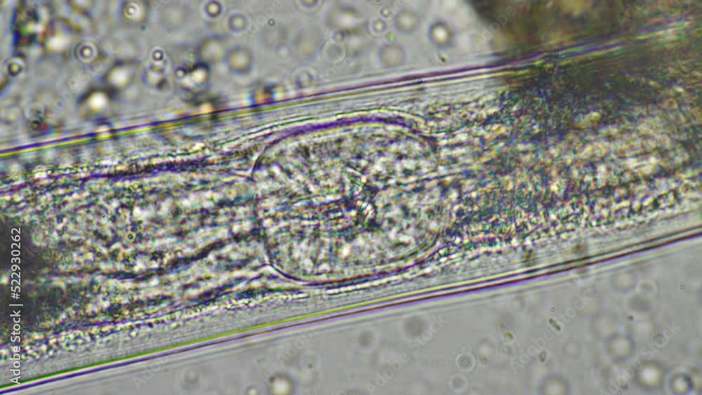 microorganisms and soil biology, with nematodes and fungi under the ...