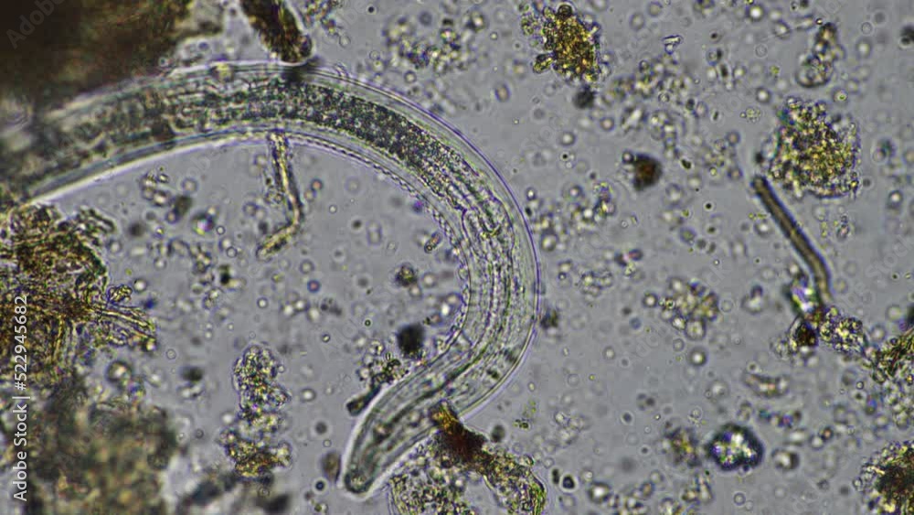 Soil bacteria feeding nematode in a soil sample off a farm in Australia ...