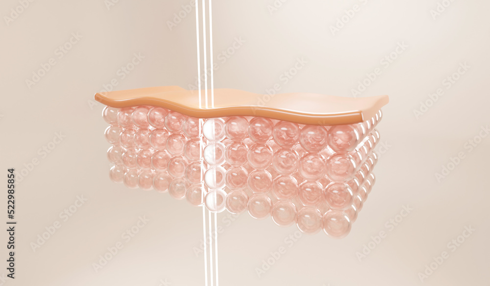 laser or serum vitamin through the skin layer for repair wrinkles and ...