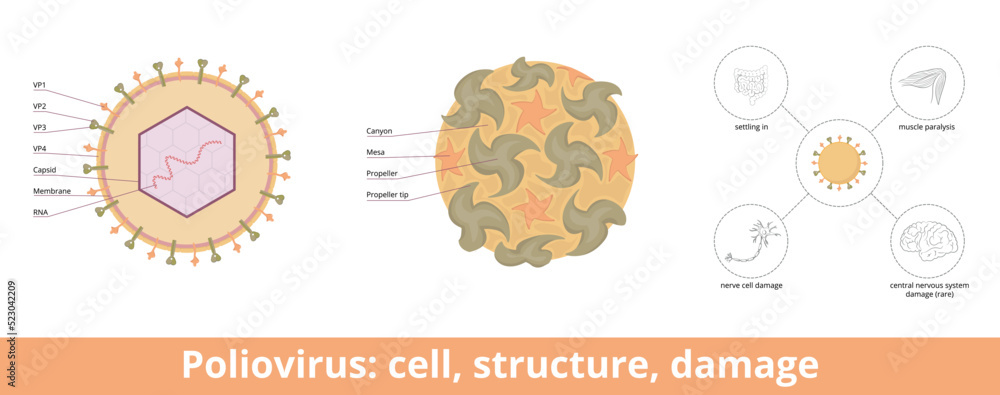 Poliovirus: cell, structure, damage. Viral cell: RNA genome and a protein capsid, glycoproteins ...