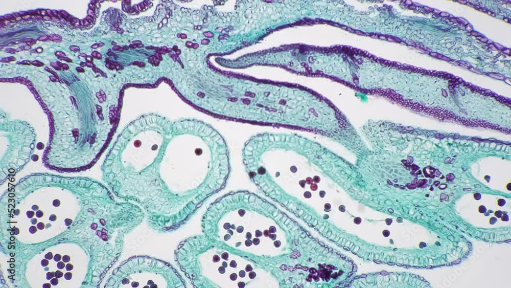 Apical bud filmed under microscope 100x in longitudinal section against ...