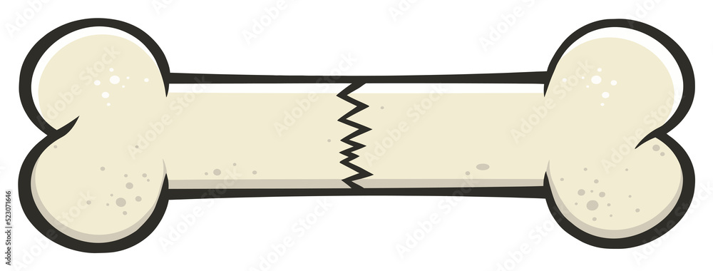 Bone Fracture Line Cartoon Drawing Design. Hand Drawn Illustration ...