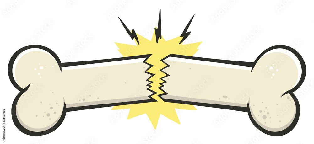 Broken Bone Line Cartoon Drawing Design. Hand Drawn Illustration ...