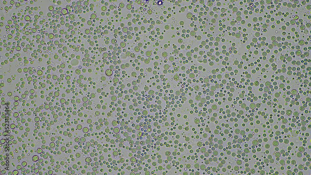 Breast milk under the microscope, woman lactating milk Feeding a baby ...