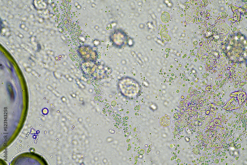 person with a virus coughing, Phlegm and mucus under the microscope ...