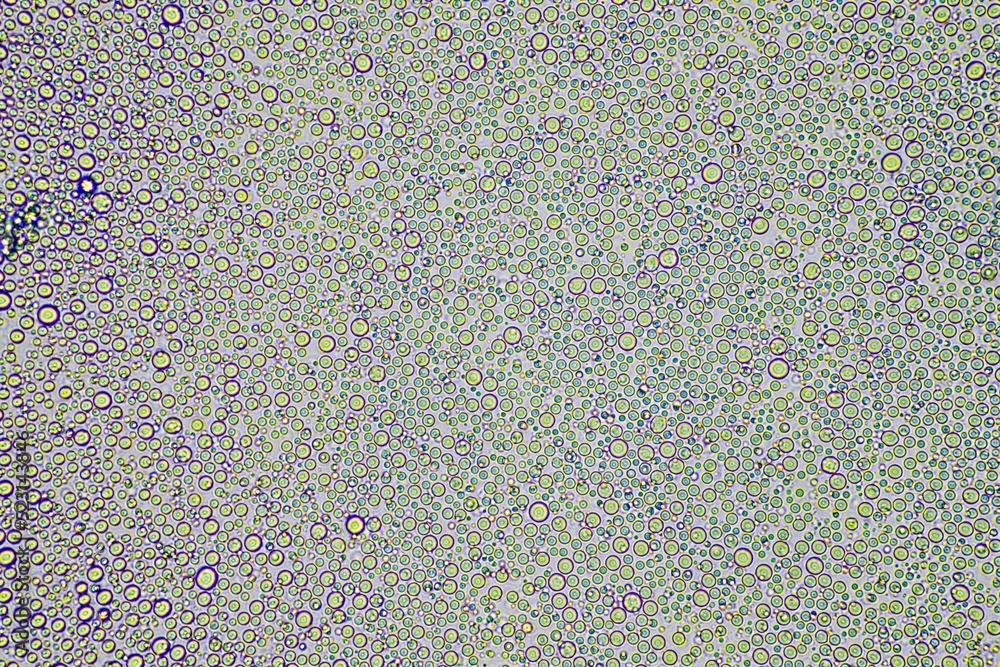 Sperm under the microscope. Looking a semen swimming. Healthy fertile ...