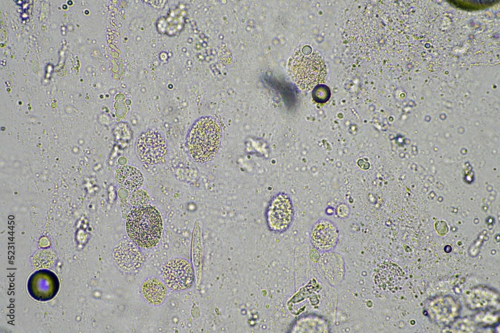 coughing, Phlegm and mucus under the microscope Stock Photo | Adobe Stock