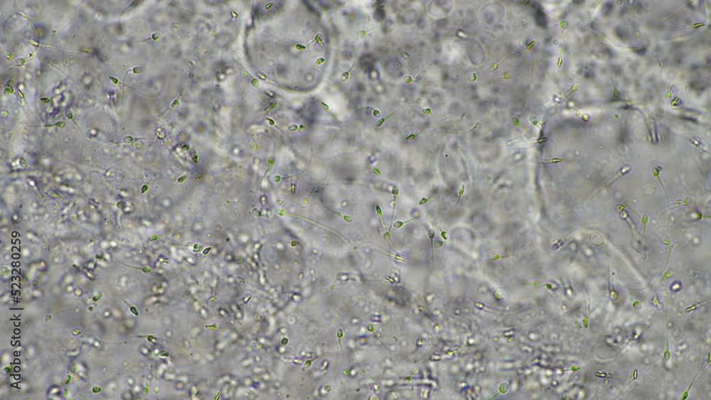 Sperm Under The Microscope Looking A Semen Swimming Healthy Fertile
