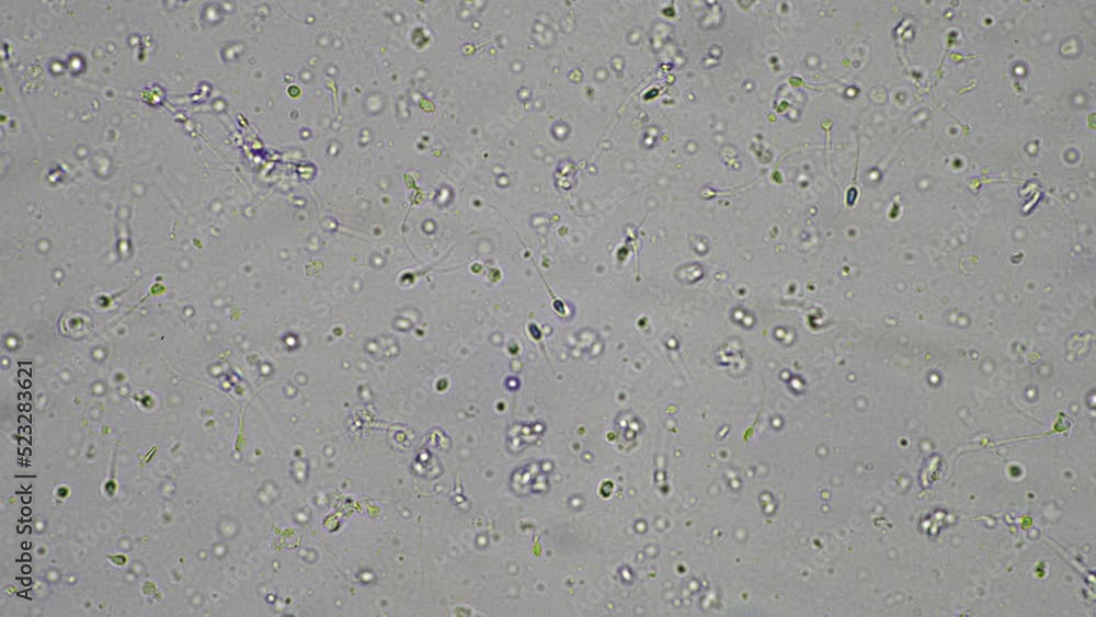 Sperm under the microscope. Looking a semen swimming. Healthy fertile ...