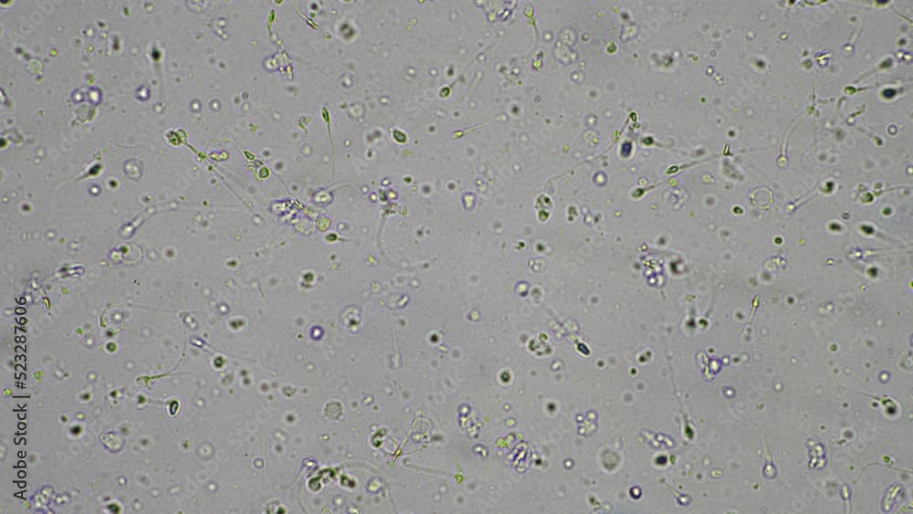 Sperm under the microscope. Looking a semen swimming. Healthy fertile ...