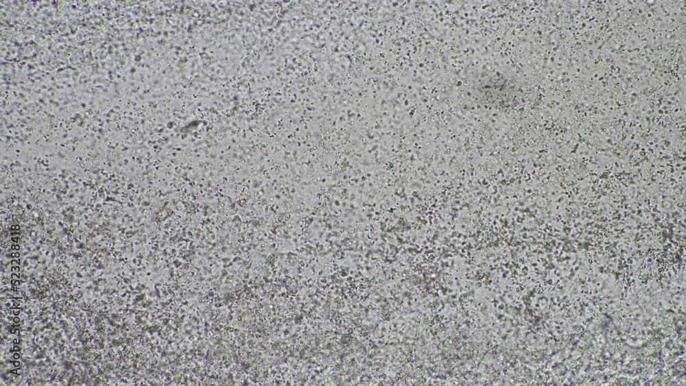 Sperm under the microscope. Looking a semen swimming. Healthy fertile ...