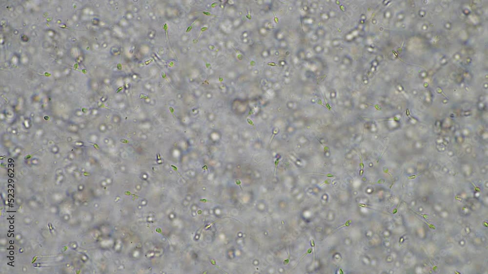 Sperm under the microscope. Looking a semen swimming. Healthy fertile ...
