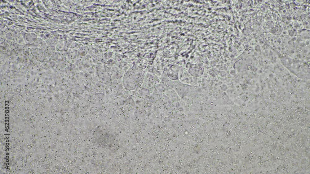 Sperm under the microscope. Looking a semen swimming. Healthy fertile ...