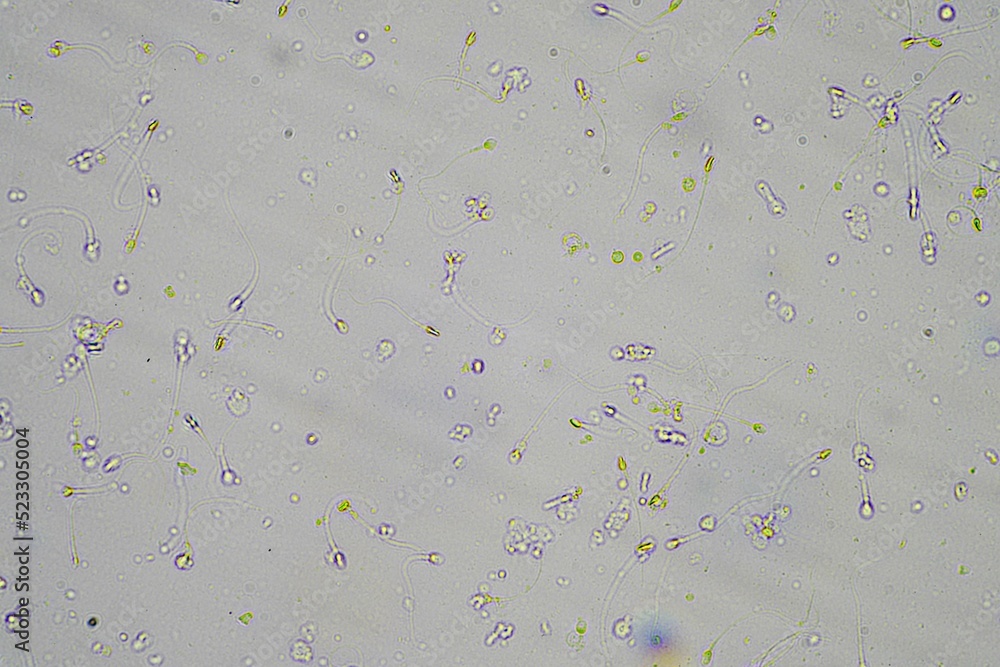 Sperm under the microscope. Looking a semen swimming. Healthy fertile ...