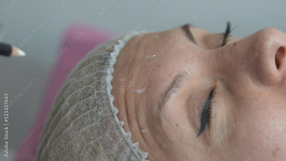 Facial injection procedure. Plastic surgery. Blockage of facial muscles ...