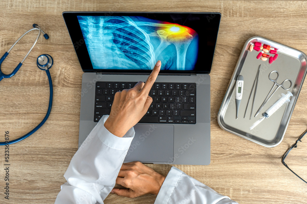 Top view of Doctor showing a x-ray of pain in the shoulder on a laptop ...