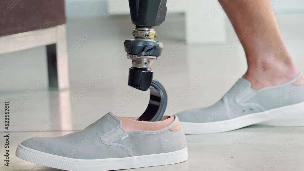 Disabled amputee man using prosthetic leg wearing shoes using leg ...