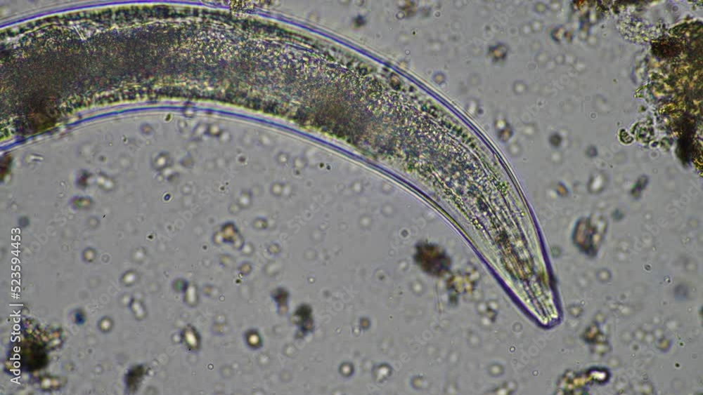 nematode in a soil sample off a farm in Australia under the microscope ...