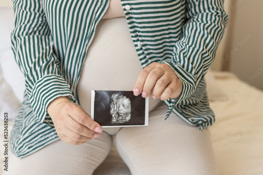 pregnant woman holding ultrasound 3d picture scan of unborn yet fetus ...