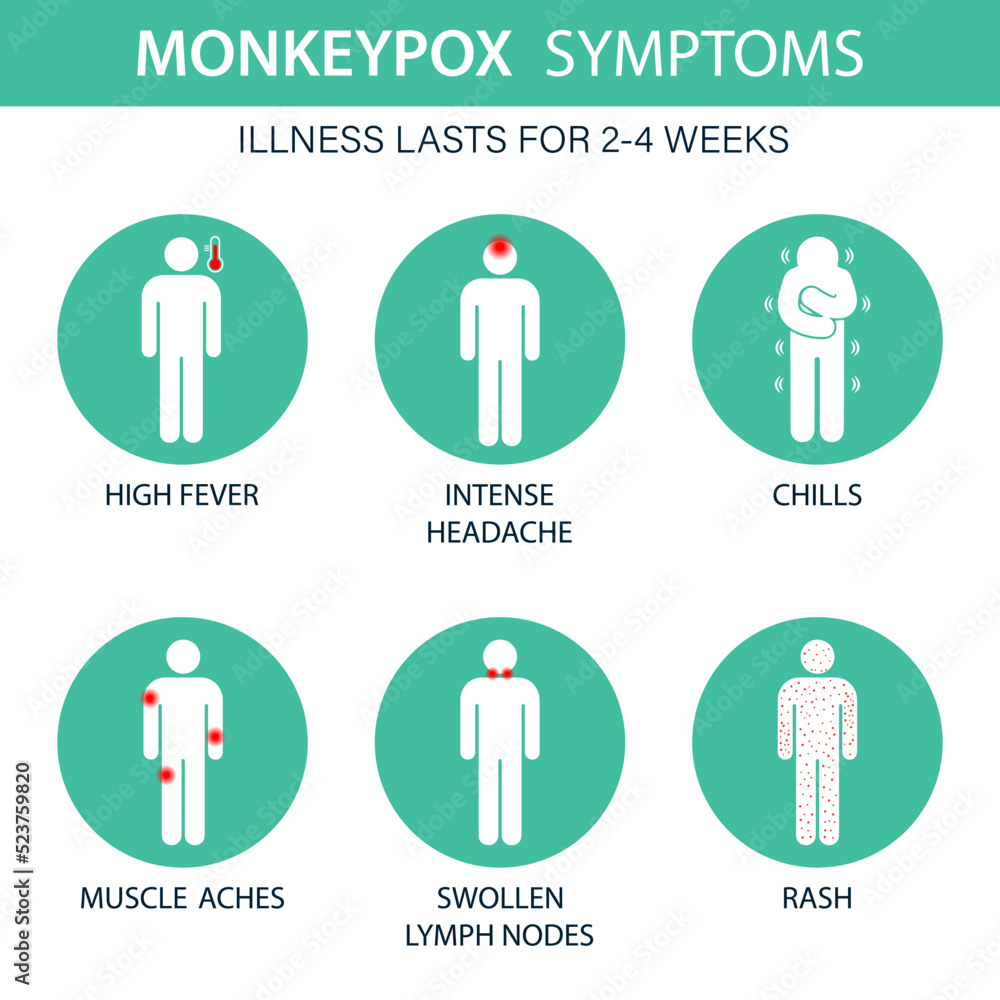 Symptoms of the monkey pox virus. Monkey pox is spreading. This causes ...