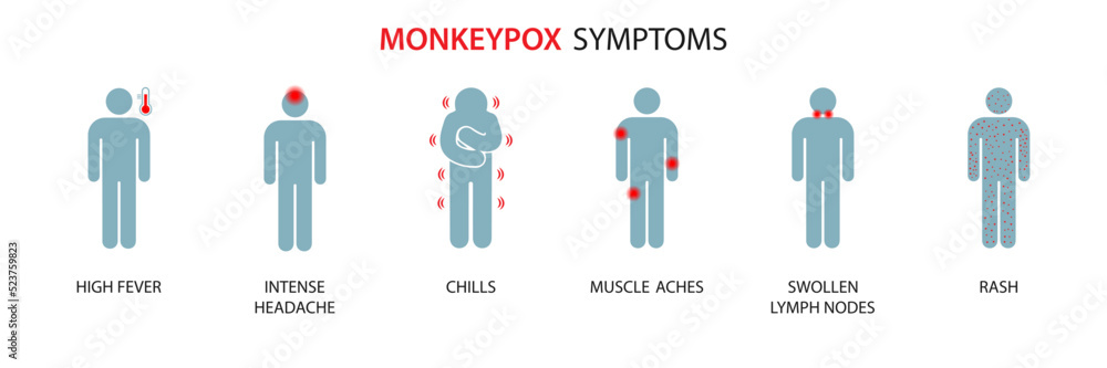 Symptoms of the monkey pox virus. Monkey pox is spreading. This causes ...
