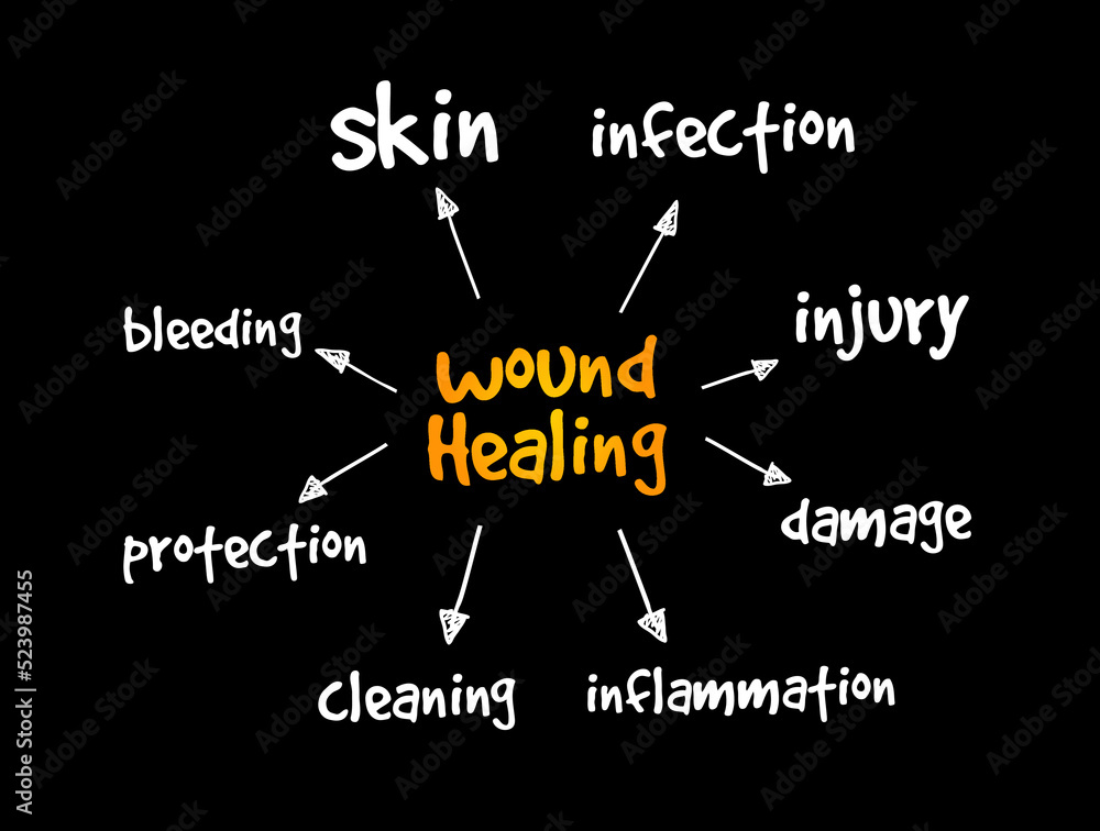 Wound Healing mind map, health concept for presentations and reports ...