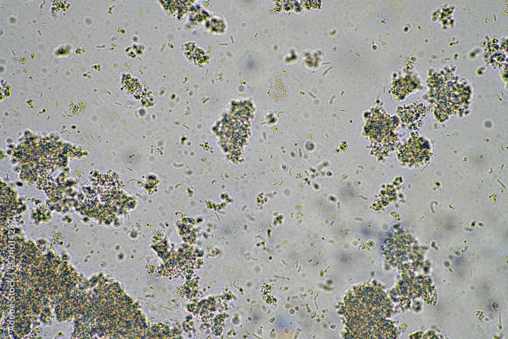 coughing, Phlegm and mucus under the microscope Stock Photo | Adobe Stock