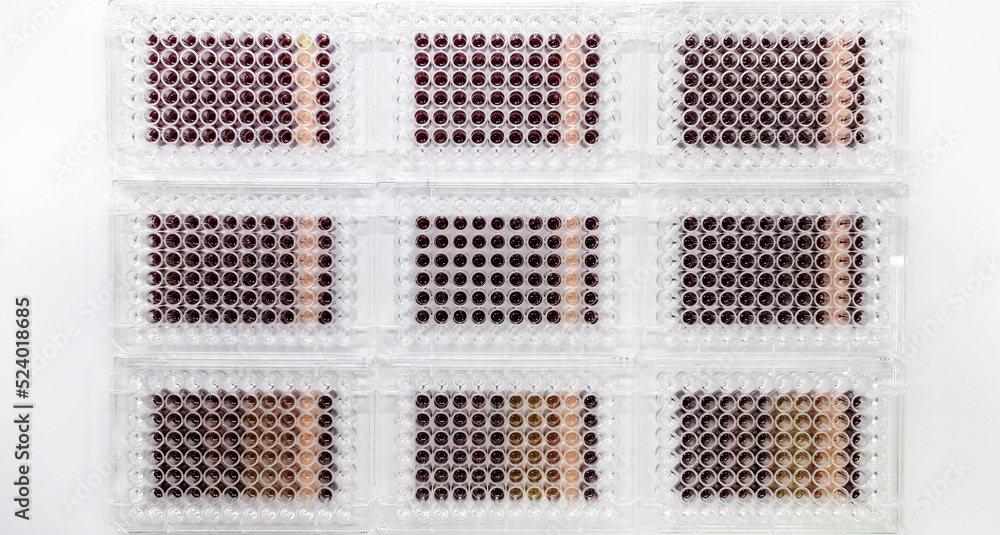 96-well plates with cancer cells cultured in vitro used in a pre ...