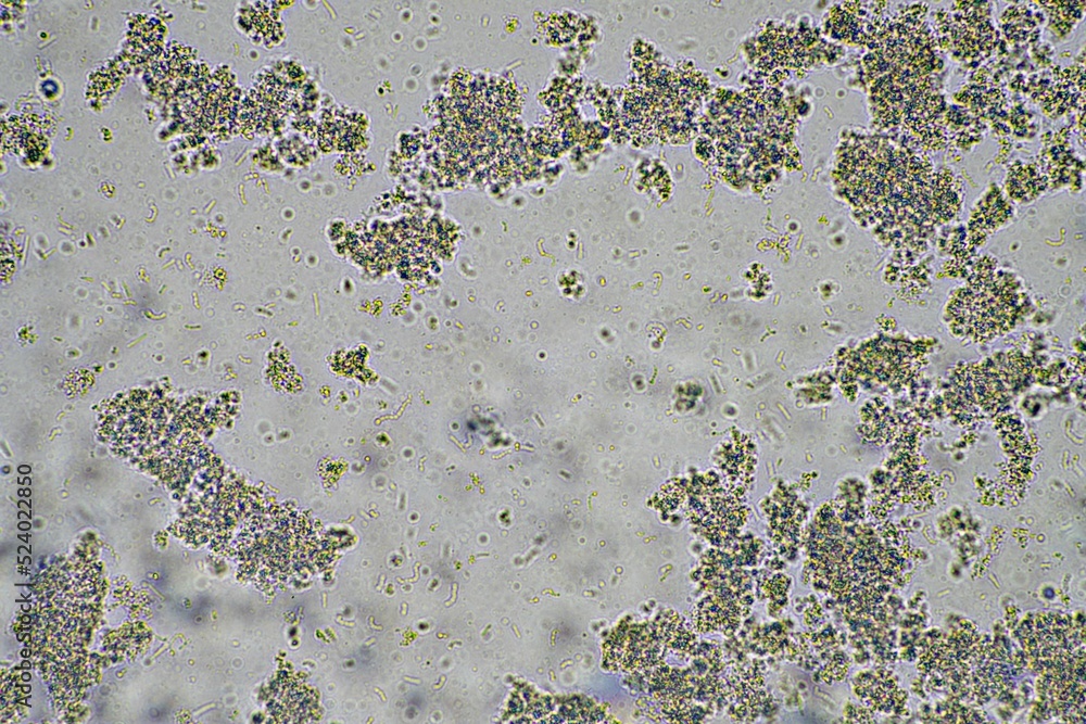 Yogurt under the microscope. Looking at lactobacillus bacteria in a ...