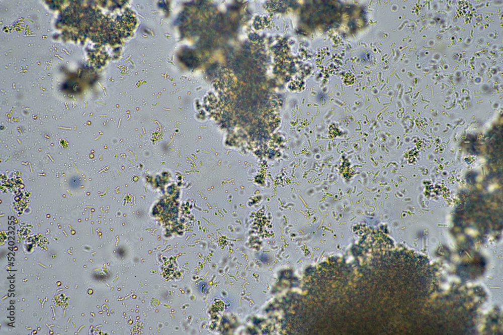 Yogurt under the microscope. Looking at lactobacillus bacteria in a ...