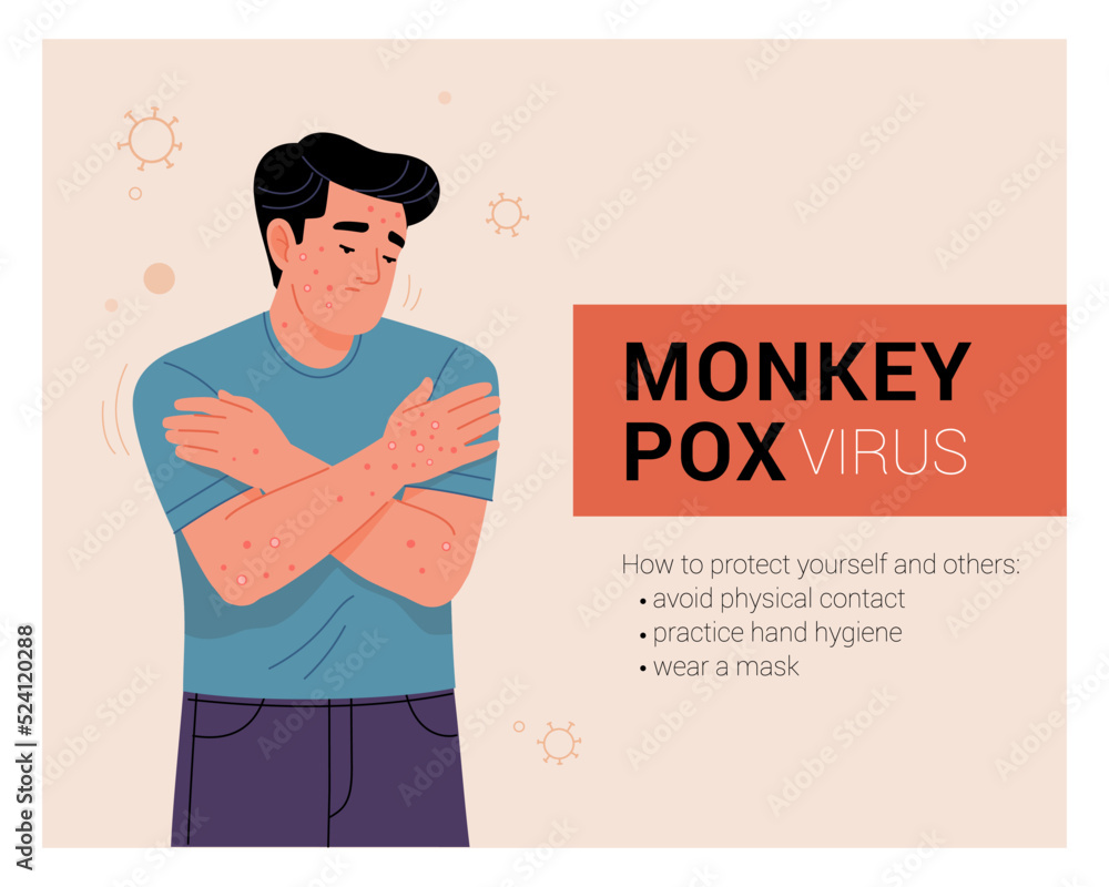 Monkeypox Virus banner template. Vector cartoon illustration of a young ...