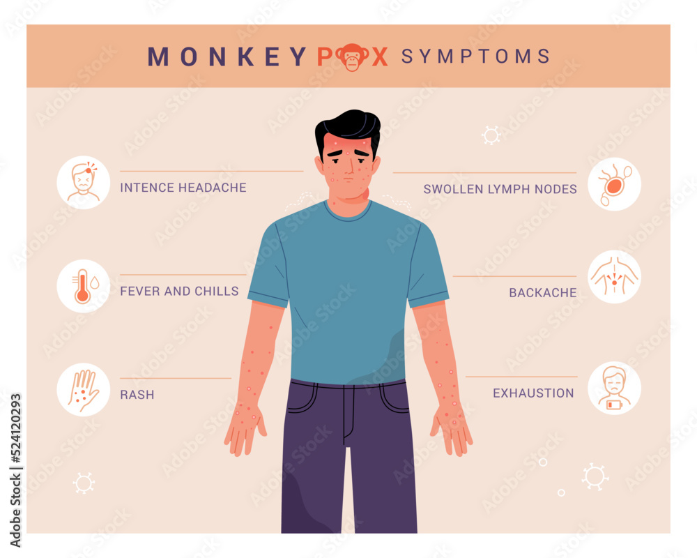Monkeypox virus symptoms. Vector illustration of a cartoon man ...