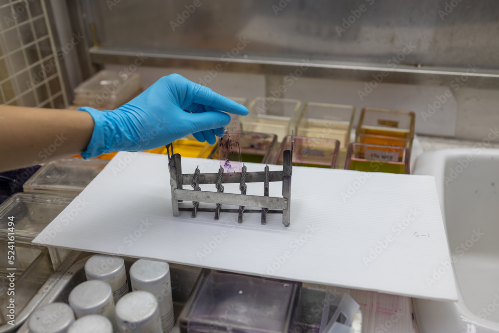 Fotka „Scientists are preparing slides cytology or pathology for the ...