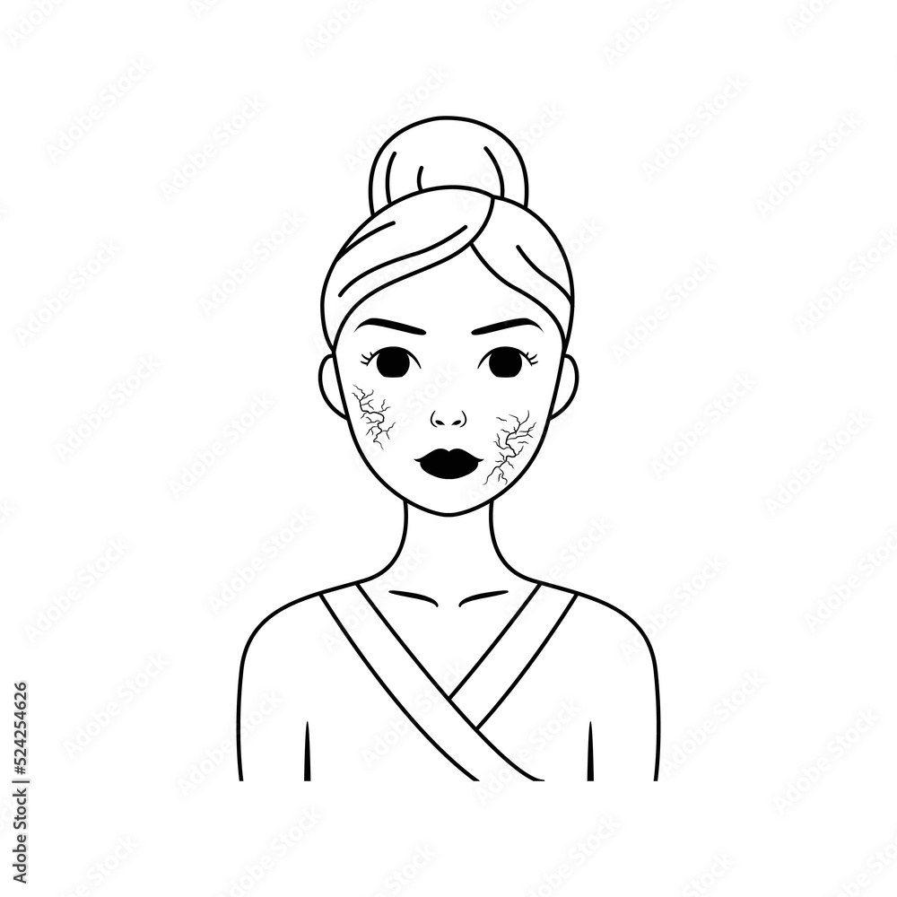 Portrait of A Beautiful Woman with Dry Skin on her Face. Problematic ...