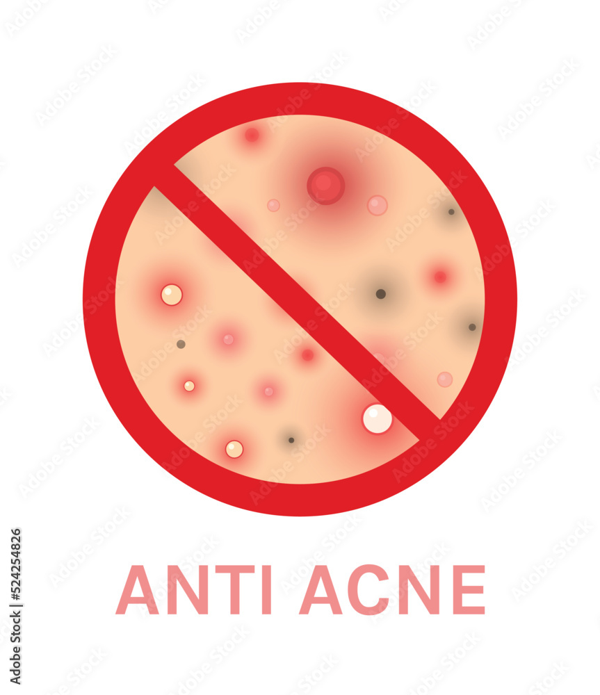 Anti Acne. Prohibition. Close up of Pimples. Problem Skin. Red and Pink ...