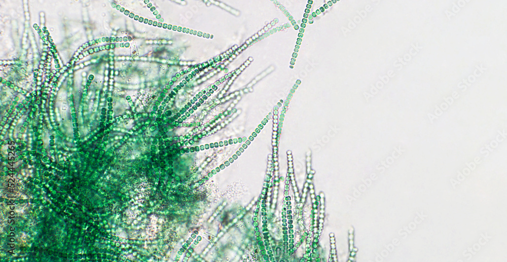 Blue green algae under microscopic view, cyanobacteria, gram-negative ...