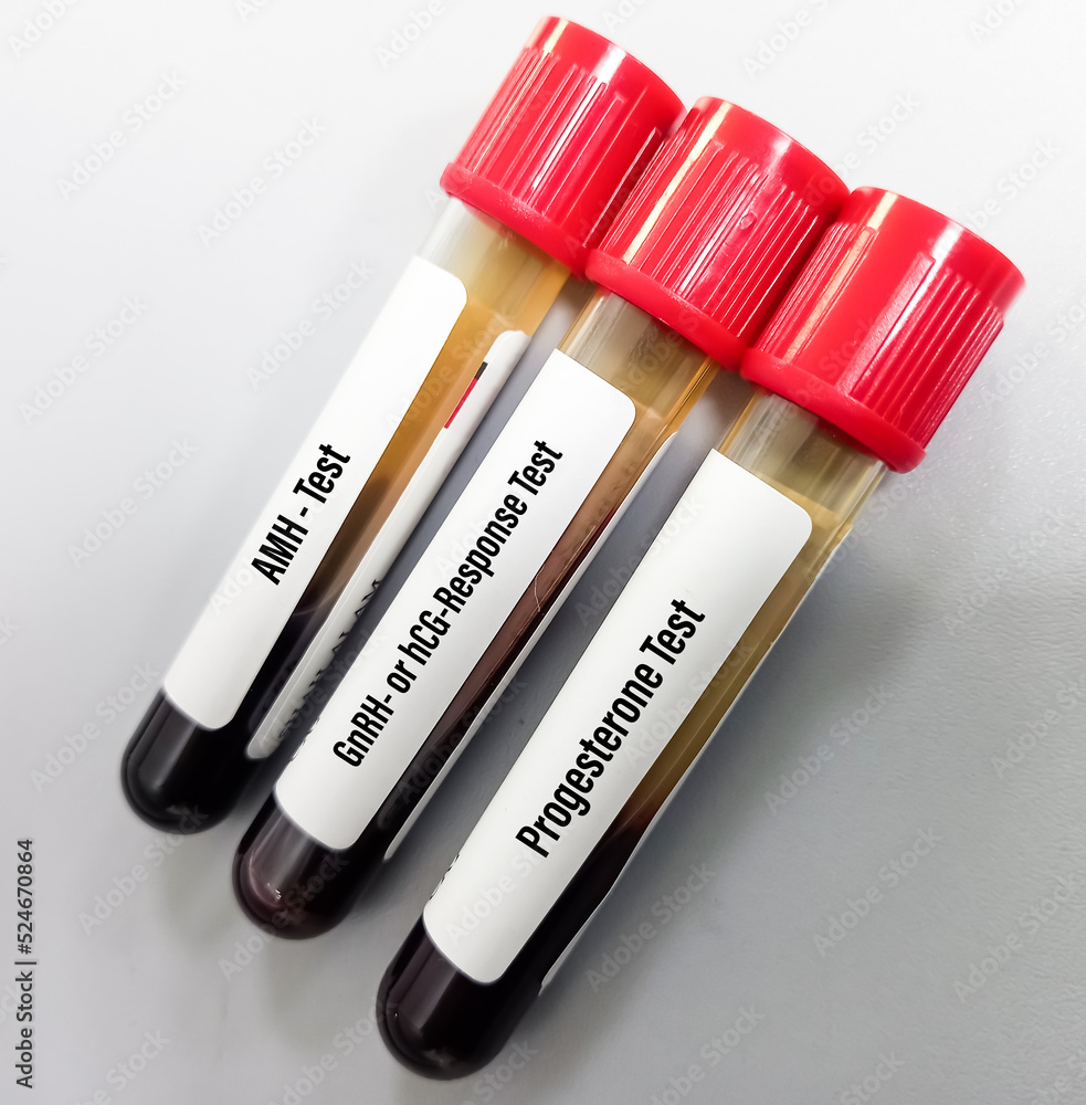 Blood sample of AMH, GnRH, Progesterone hormone test, Canine ...
