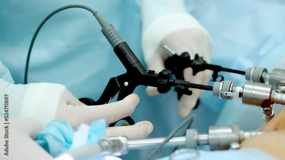 Hands of surgeons with the help of endoscopic equipment and instruments ...