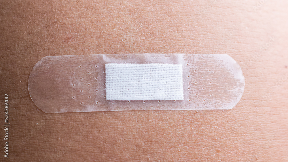 Medical adhesive plaster for close wound attachment to human surface ...